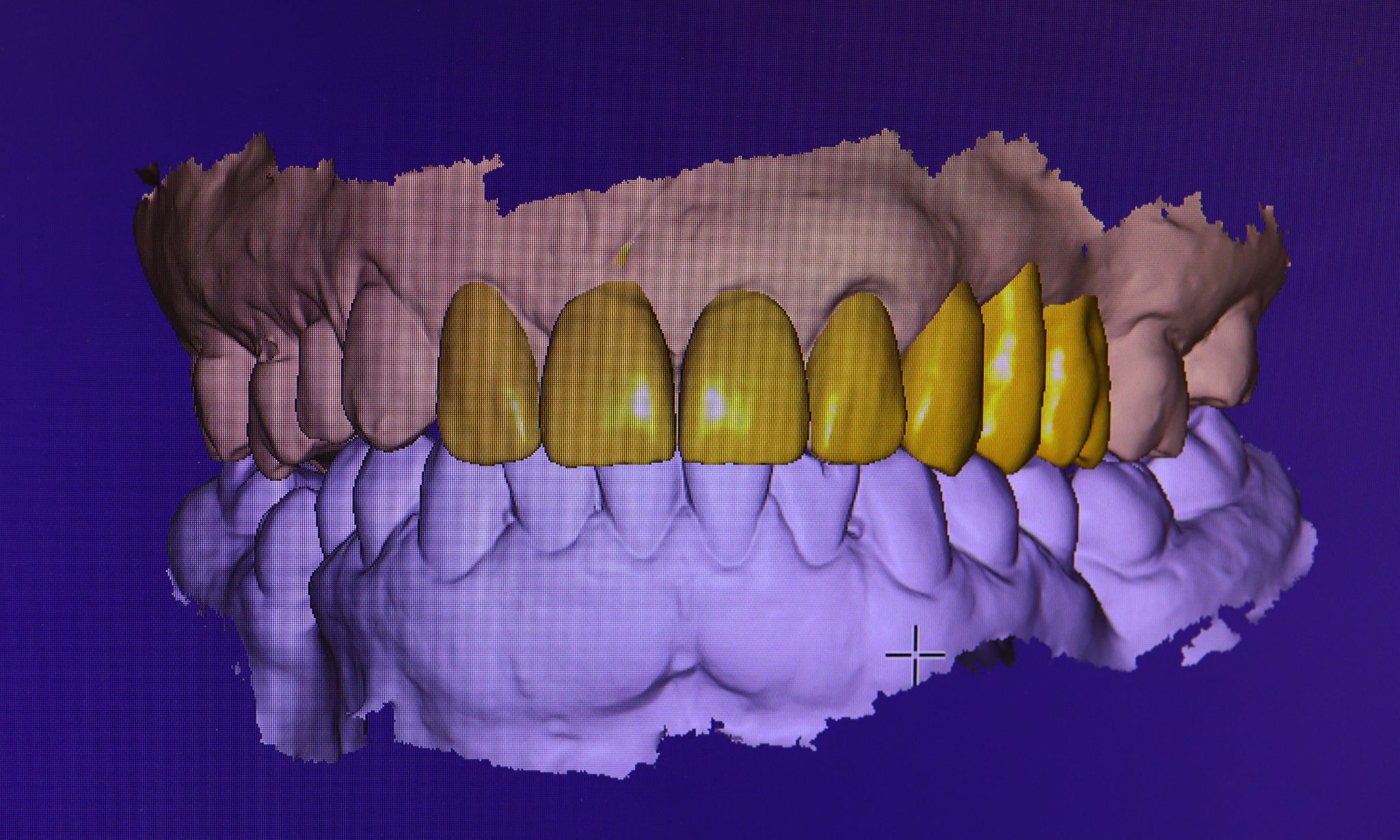 Upoznajte Dentech 3D Lab - Dentech